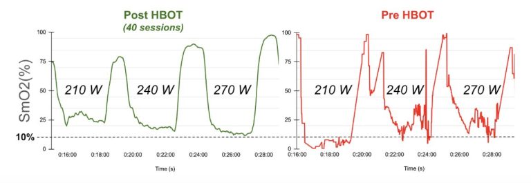 60 sessions later, we have the results: Bryan Johnson's HBOT experiment ...